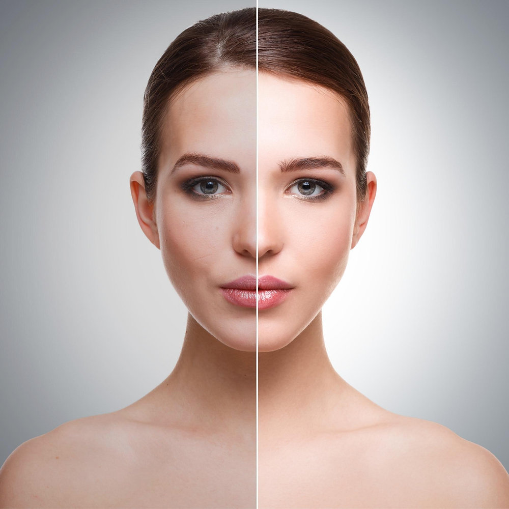 What Should You Know Before Starting a Permanent Skin Whitening ...