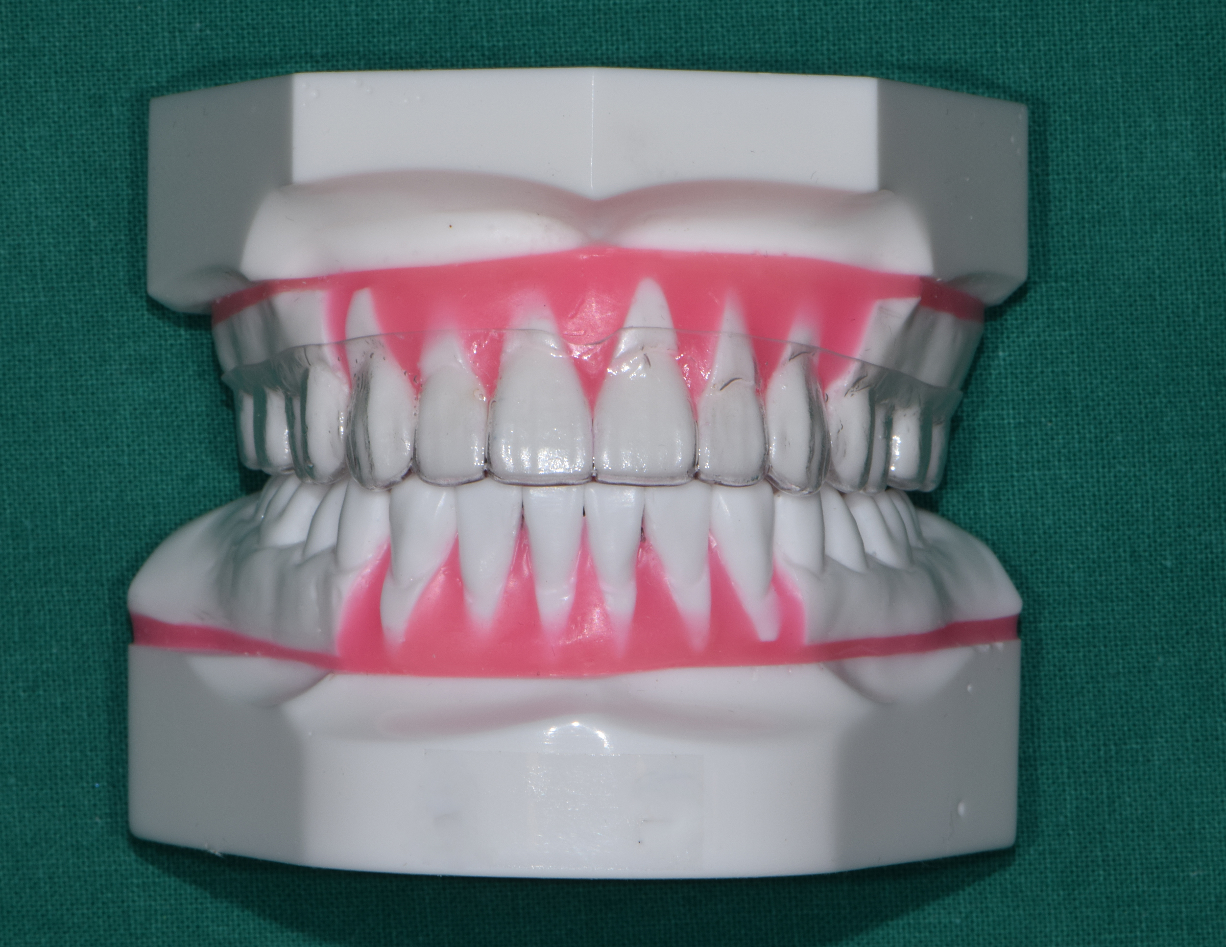 Step#1,2,3(Aligner) | seoulortholab
