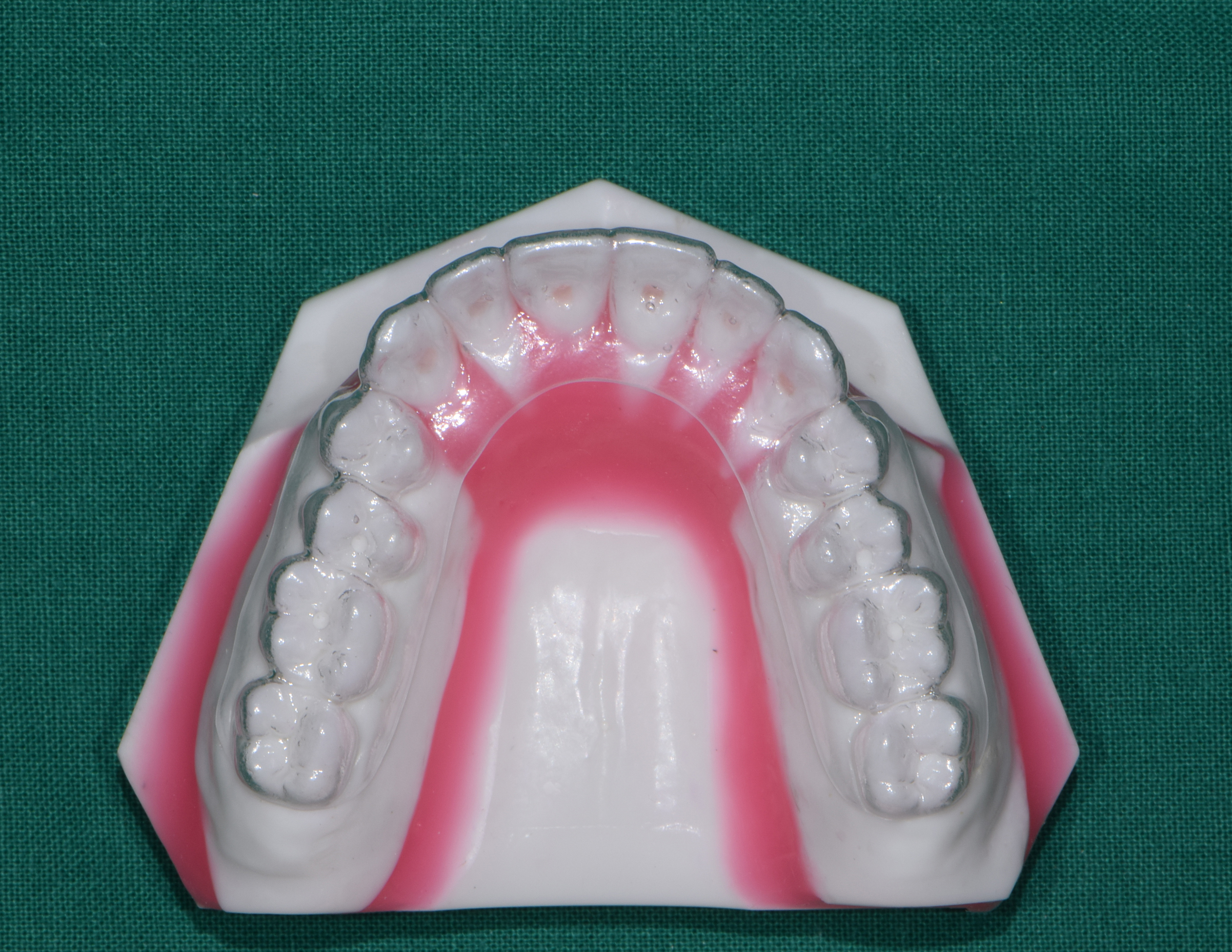 Step#1,2,3(Aligner) | seoulortholab