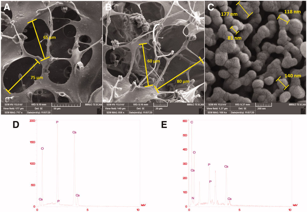 Collagen/nano-hydroxyapatite scaffolds as in situ forming hydrogel for ...