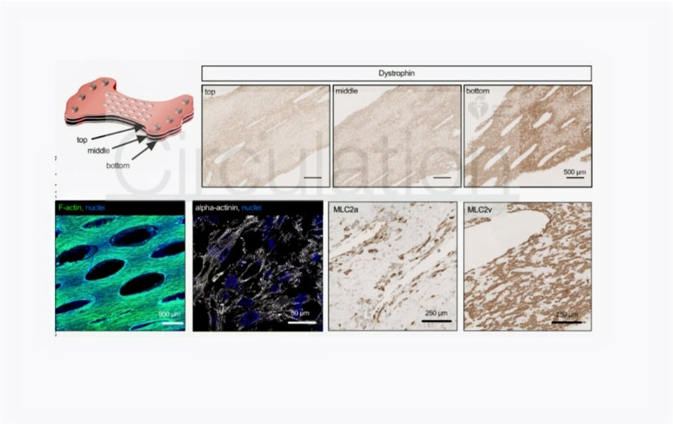 Human Engineered Heart Tissue Patches Remuscularize the Injured Heart ...