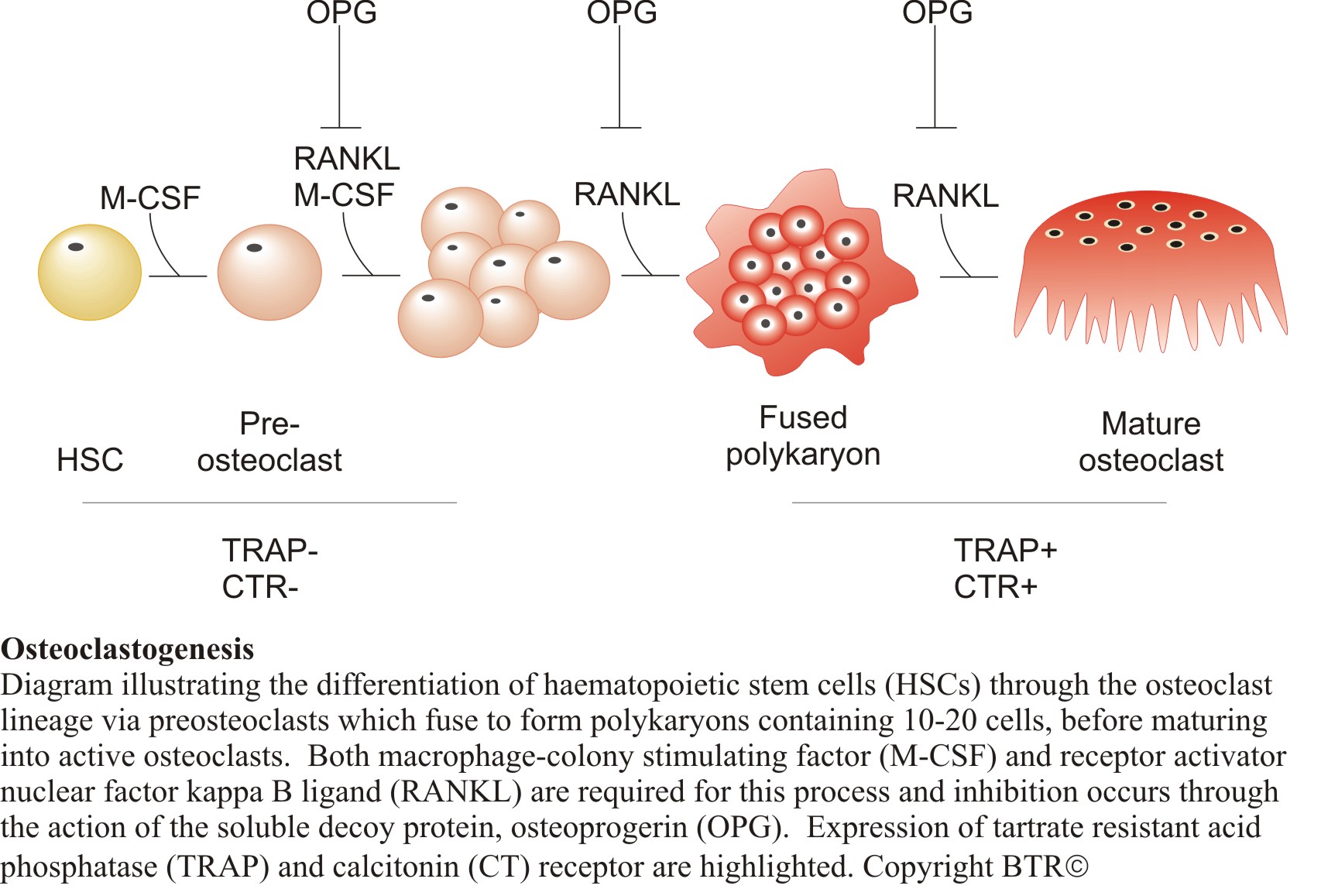 Osteoclastogenesis