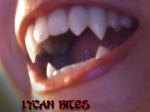 Lycan Bites | kaoskustomfangs