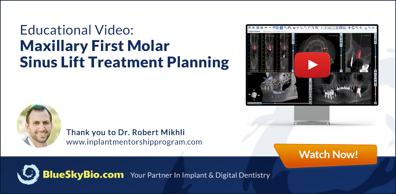 Educational Video: Maxillary First Molar Sinus Lift Treatment Planning