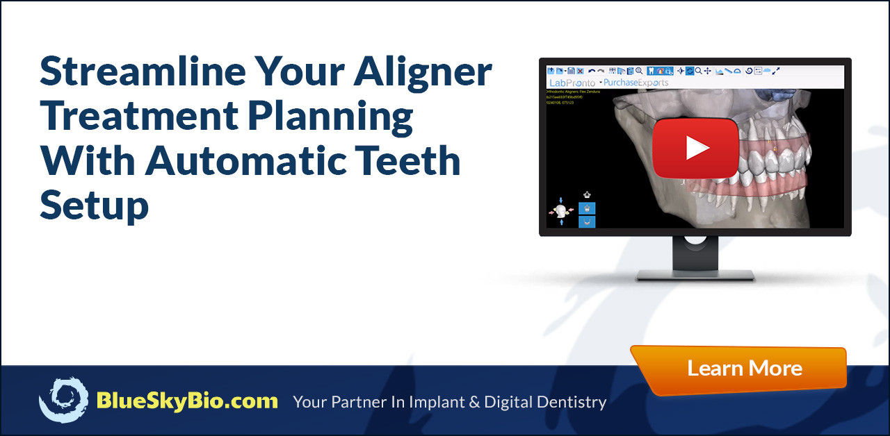 Streamline Your Aligner Treatment Planning With Automatic Teeth Setup