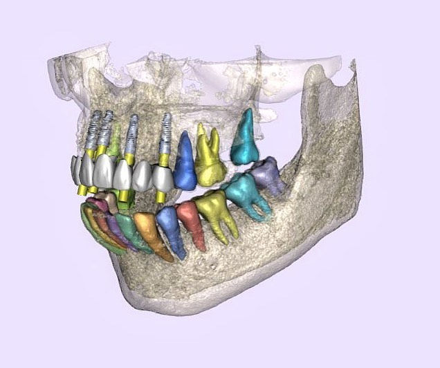 Dr. Scott Ganz Reviews The Cutting Edge Automatic Segmentation in ...
