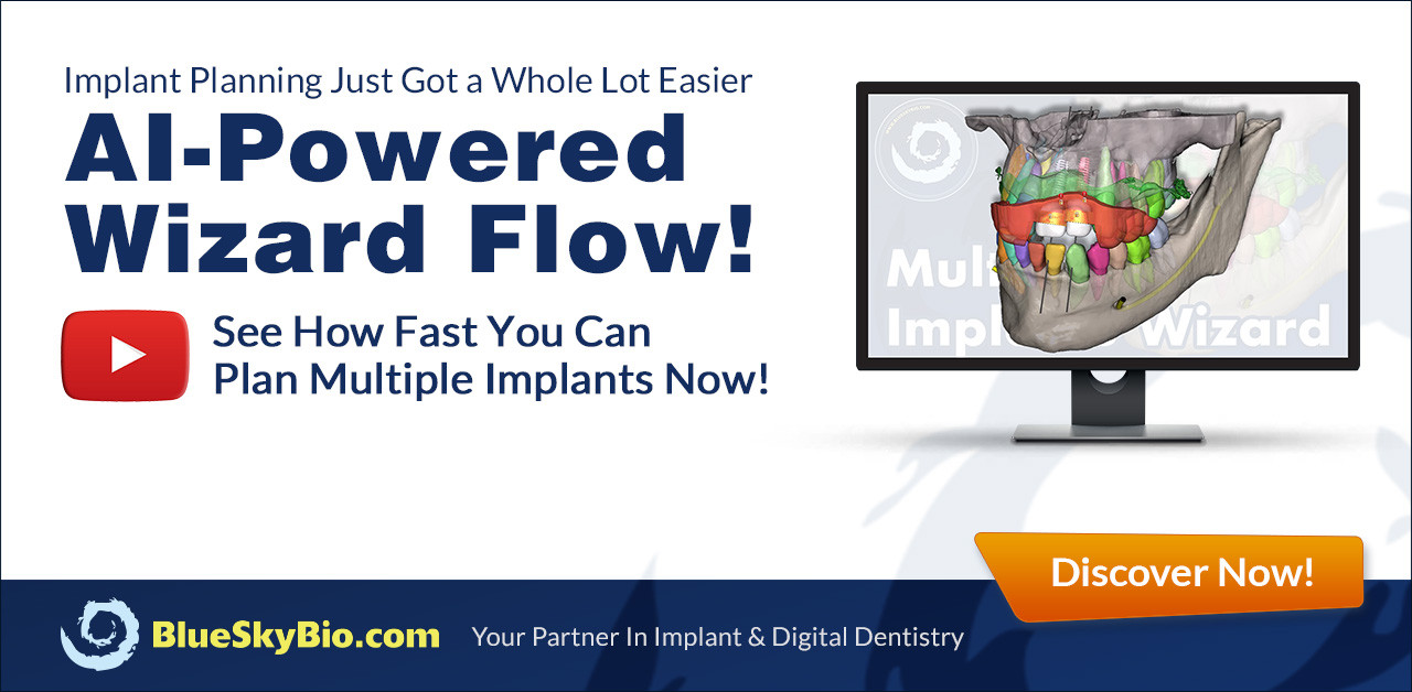 🤯 See How Fast You Can Plan Multiple Implants Now! AI Powered Wizard Flow!