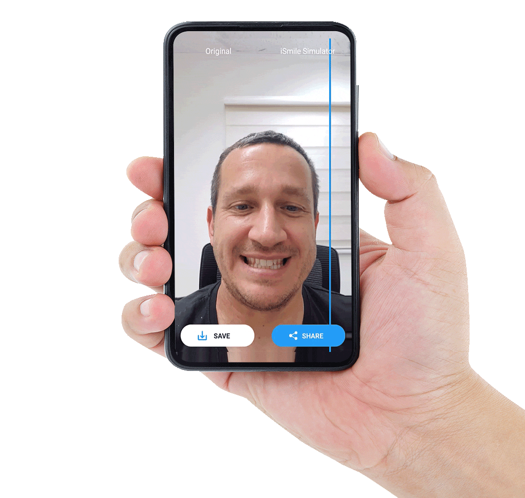AI-Powered Smile Simulation (beta) Available FREE in the Palm of Your Hand