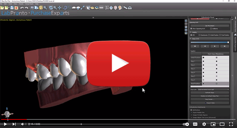 AI-Powered Automatic Aligner Button Placement Now Available In BlueSkyPlan!