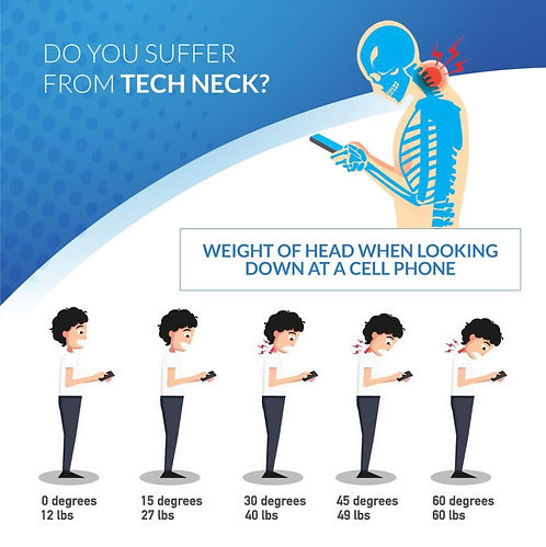What is Tech-Neck? | TechRest Pillow