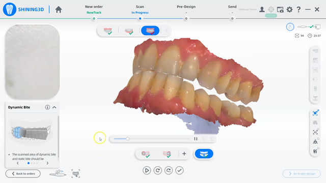 Jaw Motion Module - Coming Soon!