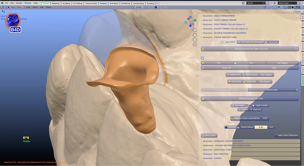 Revolutionising Custom Abutments and Implant Bars