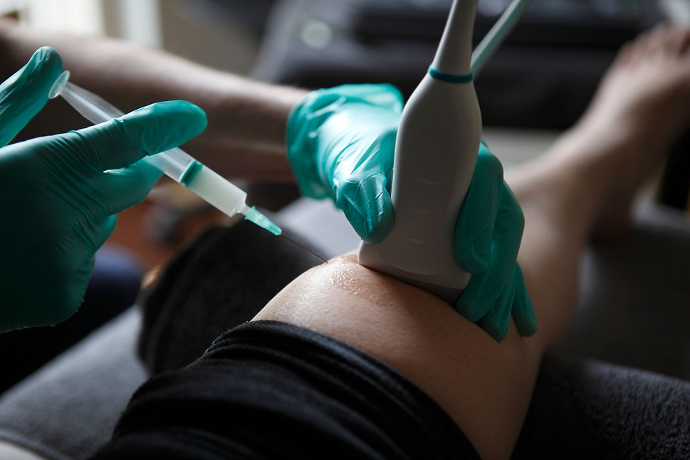 Cortisone Injections in South London | Insight MSK