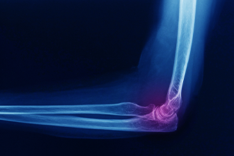 Podcast Series: Can't Miss X-rays in Urgent Care Part 2 (Extremity Xray ...
