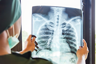 Podcast Series: Can't Miss X-rays in Urgent Care Part 1 (Chest Xray ...