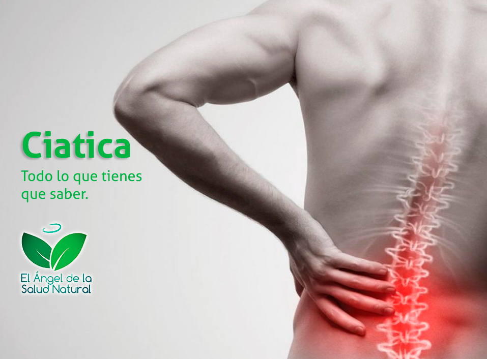 Ciatica, todo lo que tienes que saber