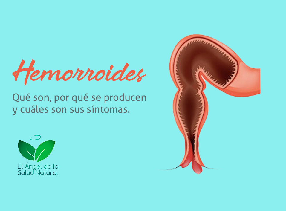 Las Hemorroides
