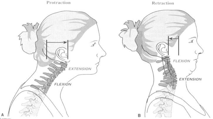 Retificação da lordose cervical: como praticar as posturas do yoga.