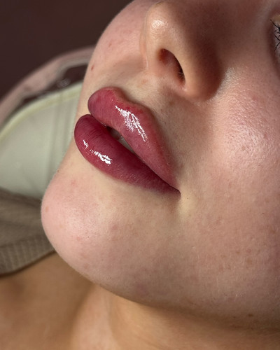 3D Russian Lip Masterclass - Group | Urban Angel Aestheti