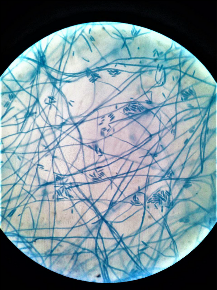 Study of fungi isolated from pharmaceutical cleanrooms: Types and origins