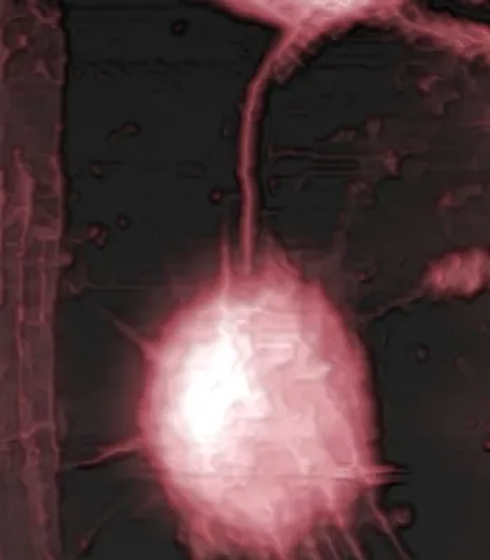 Revolutionizing Cancer Treatment: Exploring Nanoworld with Atomic Force Microscopy