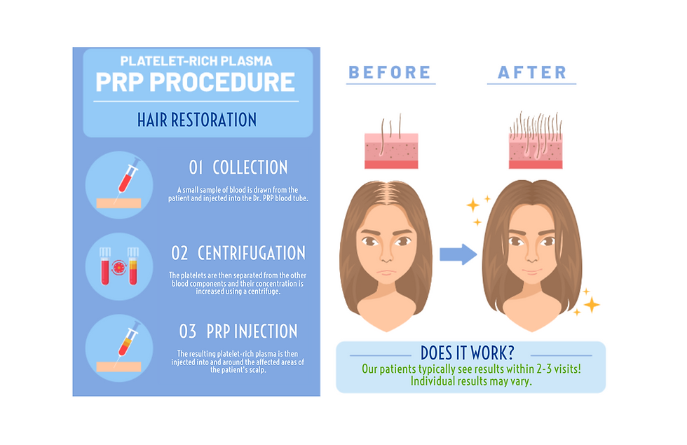 PRP for Hair Restoration | Solutions Med Spa