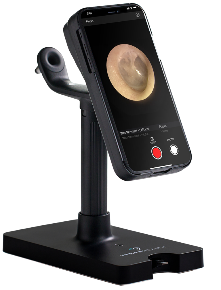 Ear Wax Removal Bristol | Hear Easy | England