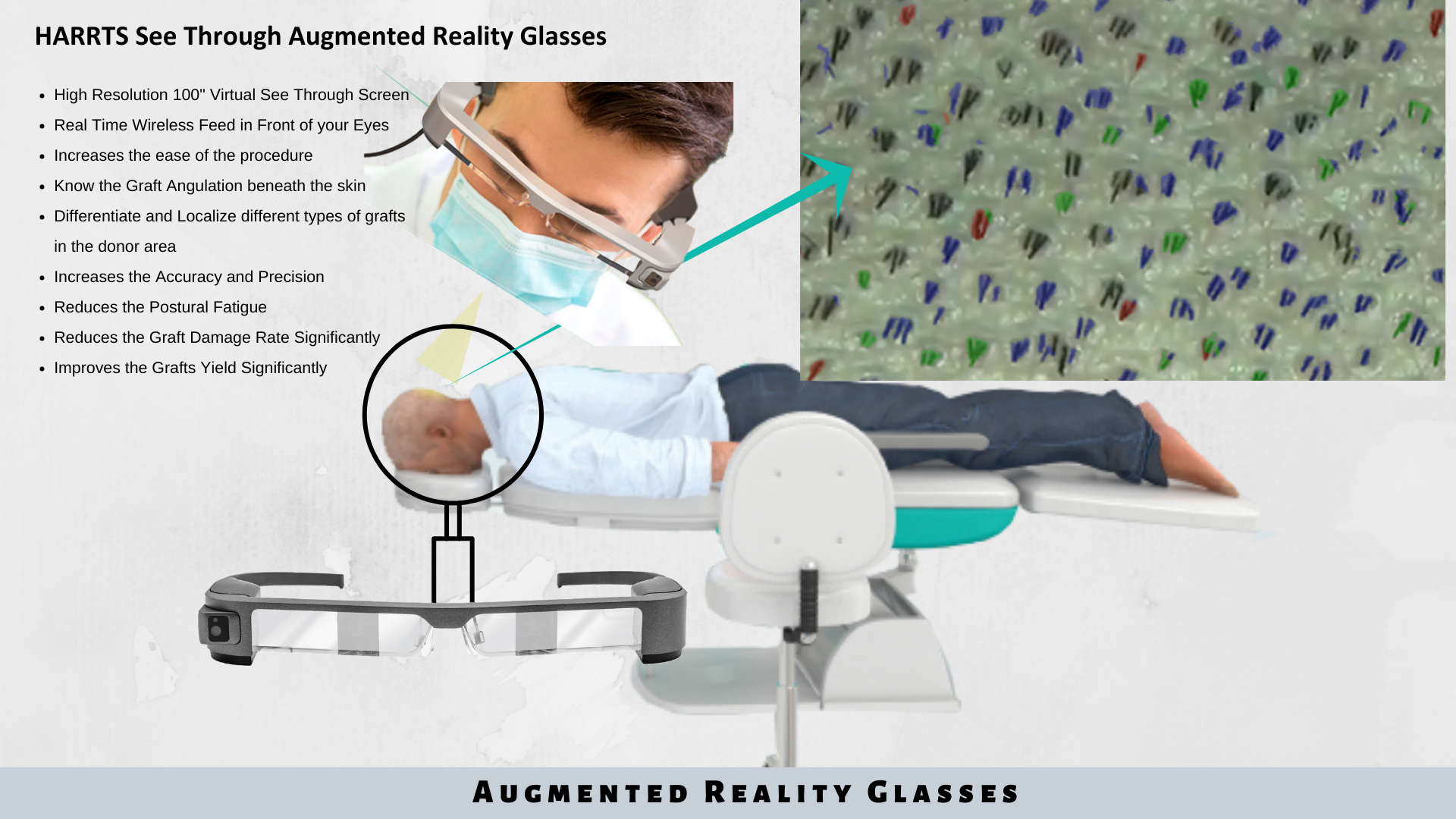 HARRTS AI Precision FUE Hair Transplant System