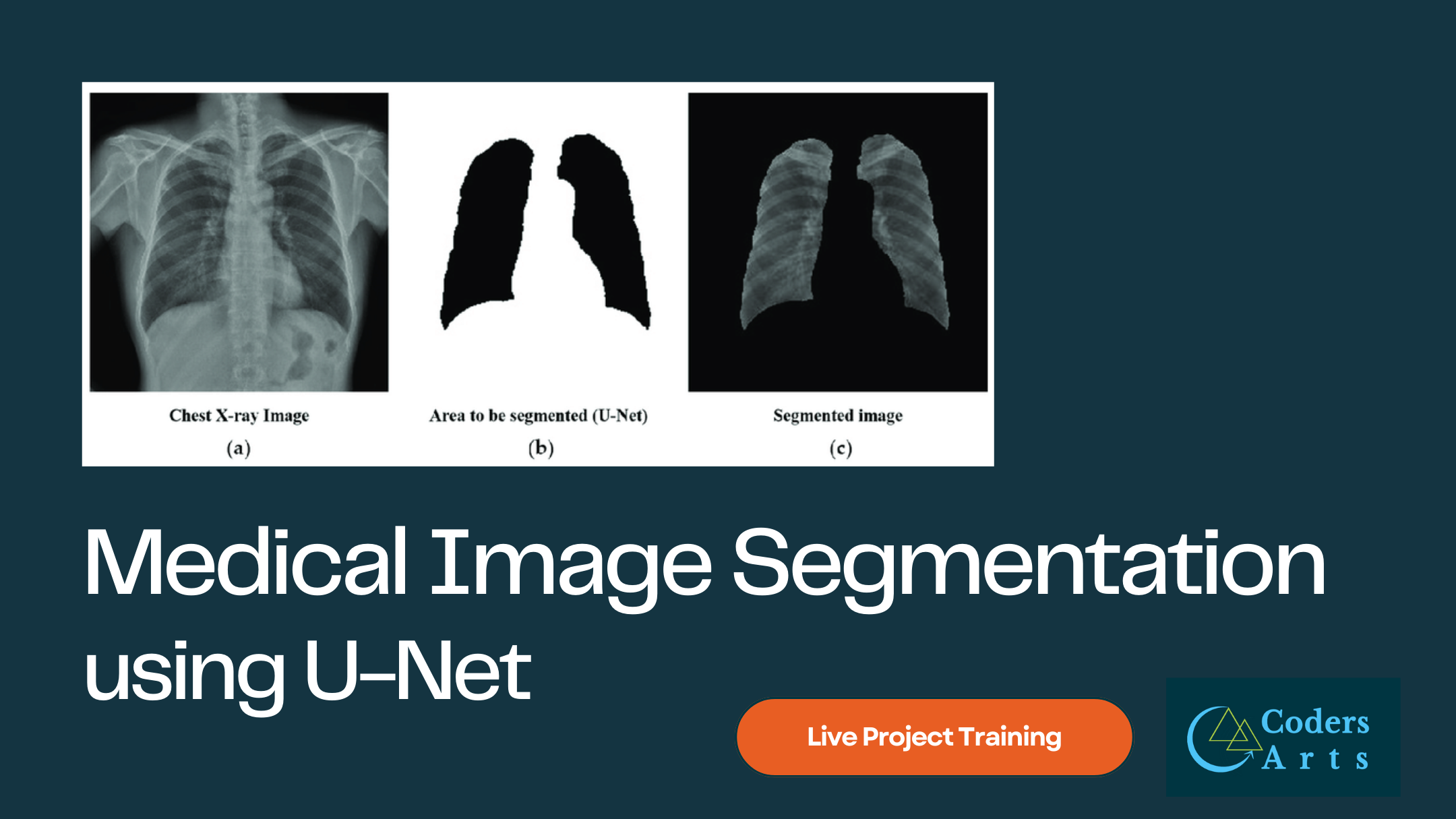 Medical Image Segmentation using U-Net | Live Project Training | Codersarts