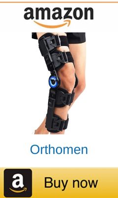 Lateral collateral ligament (LCL) tears or sprains – Symptoms ...