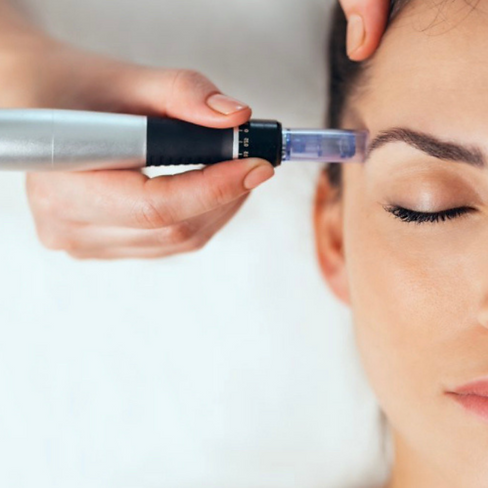 Microneedling & Dermaplaning | Bare Skin Studio