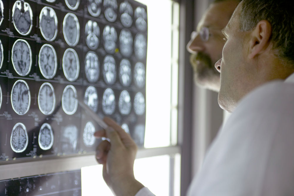 Back to the Basics: What is the difference between a neurologist & a ...