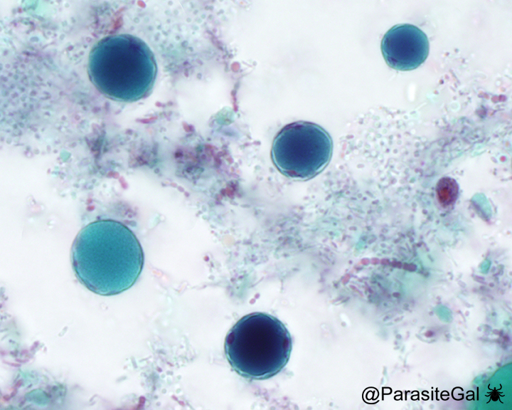 Blastocystis hominis