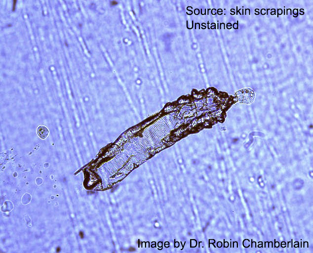 Demodex mite