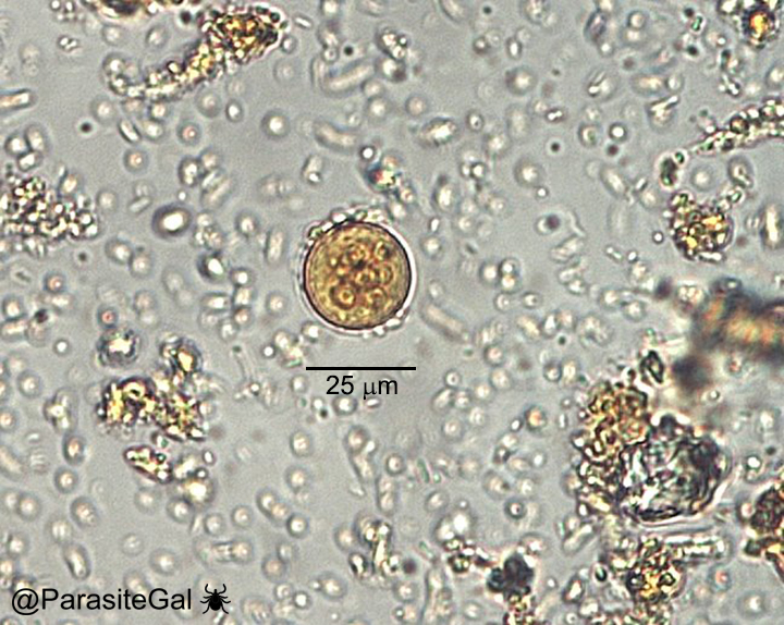 Entamoeba coli cyst