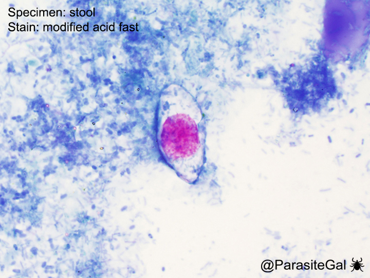 Cystoisospora belli oocyst