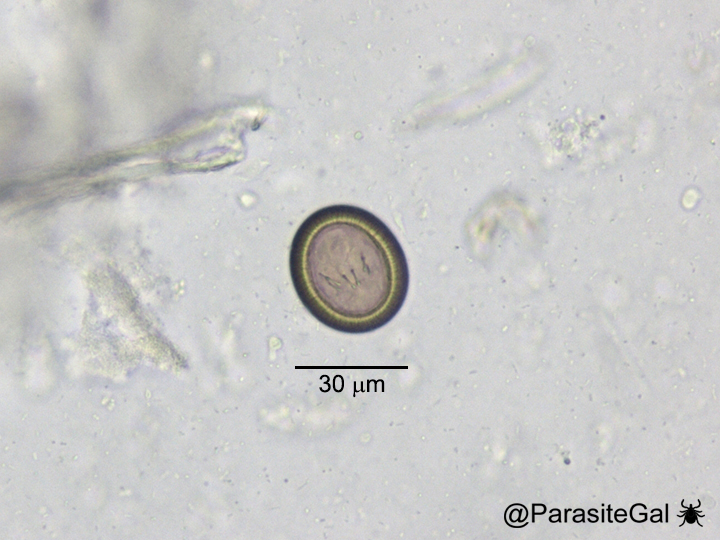 Taenia species egg