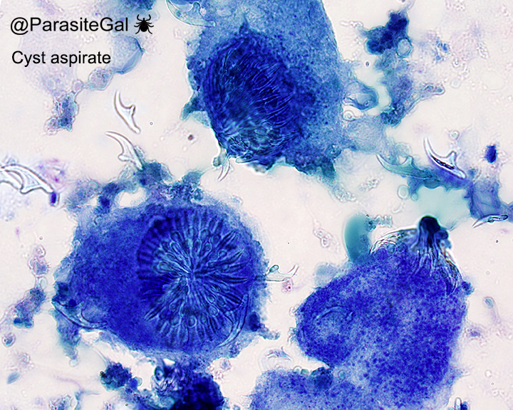 Echinococcus protoscoleces and hooklets