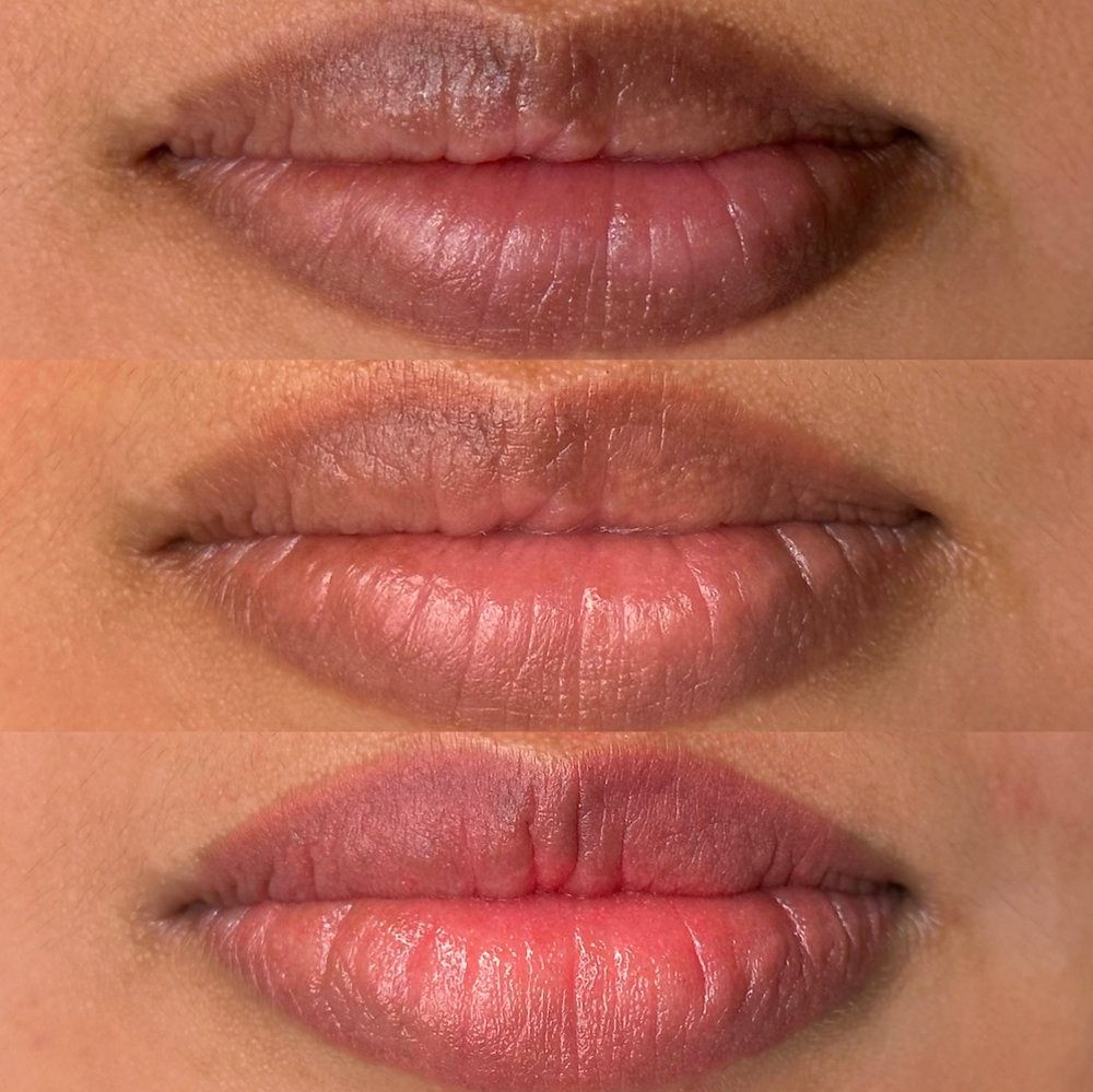 Lip Neutralization
