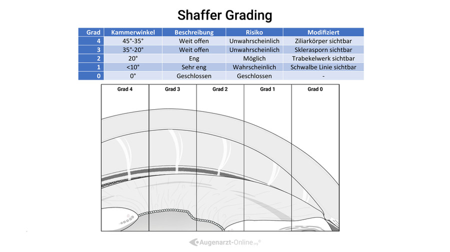 Beurteilung des Kammerwinkels | Lexikon der Augenheilkunde