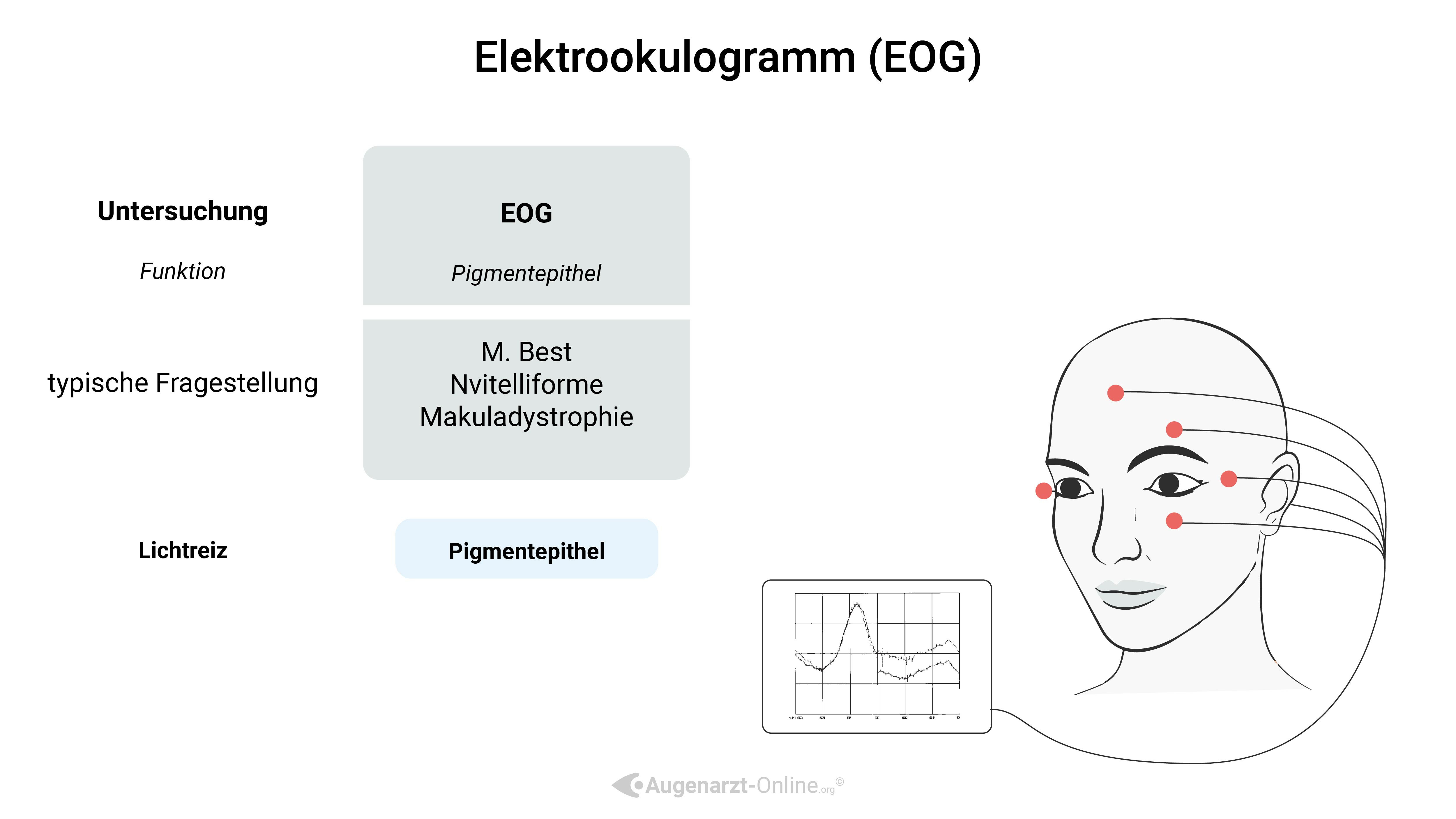 Elektrookulogramm (EOG) | Lexikon der Augenheilkunde