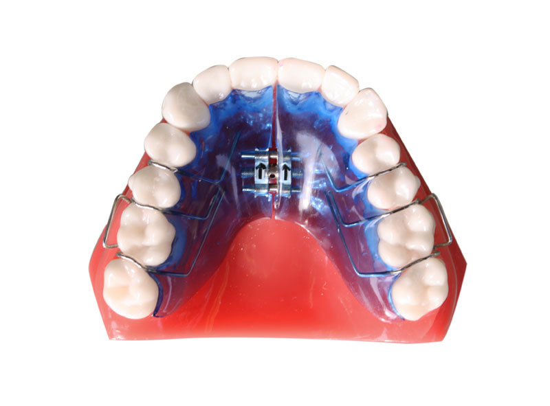 NimroDENTAL Full Arch Appliance Demonstration Model