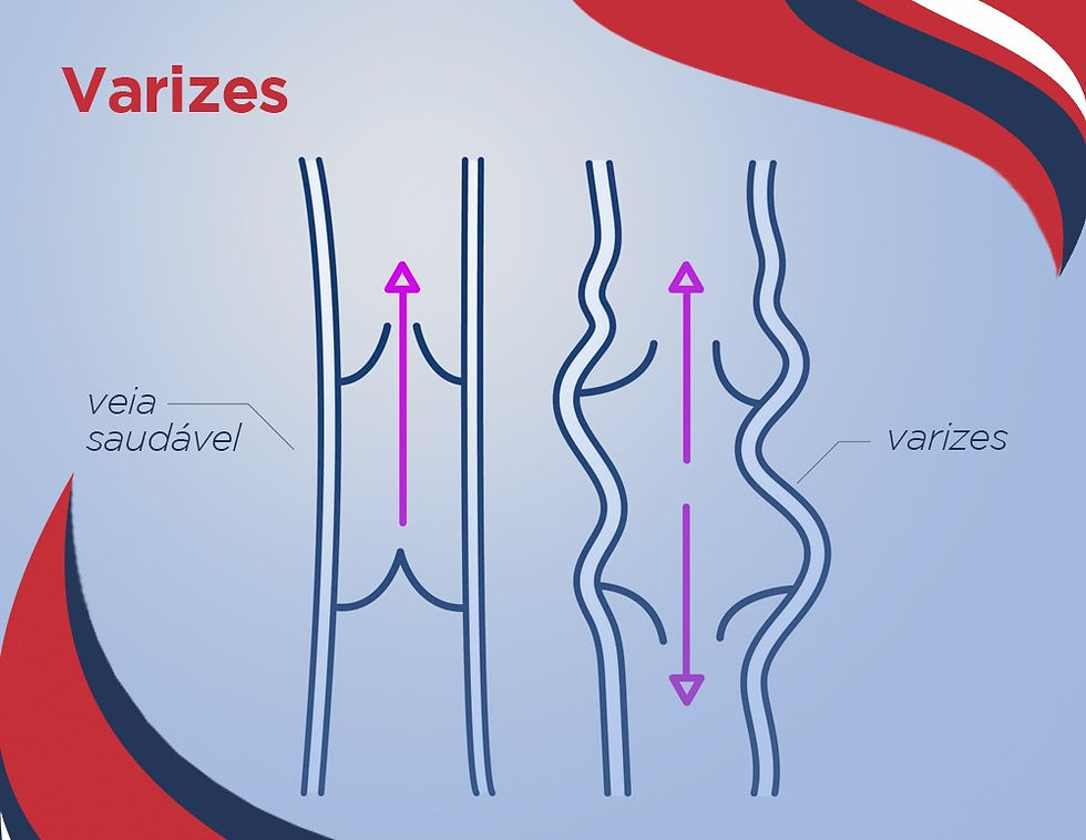 Blog | Dr. Eduardo Dallacqua Vascular | Brasil