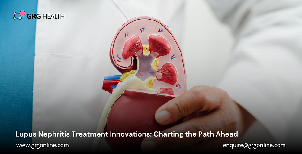 Lupus Nephritis Treatments: Advancements & Precision Care