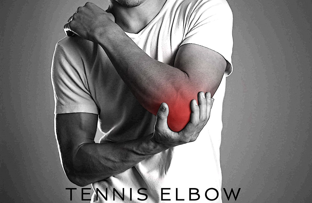 Tennis Elbow Lateral Epicondylitis Condition - Pain, Treatment ...