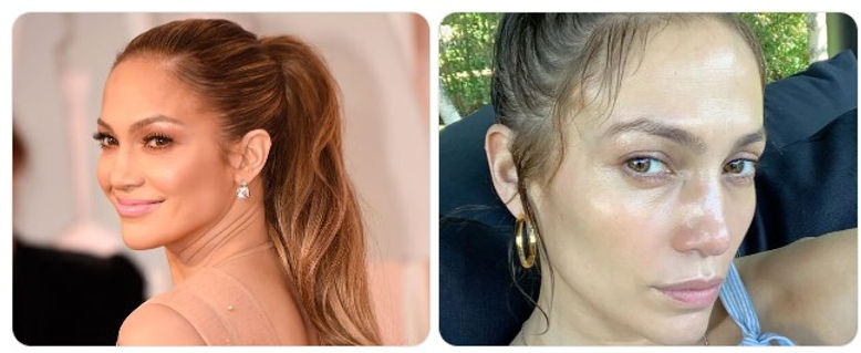La piel de Jennifer Lopez: ¿mito, genética o medicina estética?
