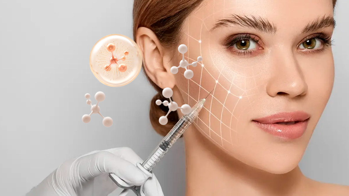 Sculptra: Bioestimulador de colágeno