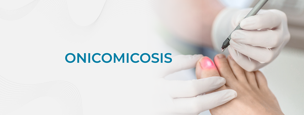 Onicomicosis:¿Que es y como tratarlo? I Medi Esthetic