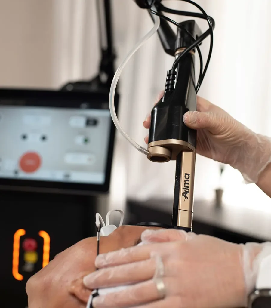 Skin Texture Treatment in Mentor, OH | Pura Vida Wellness