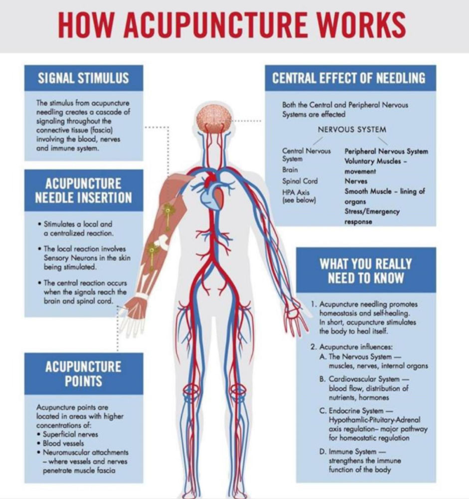 How does acupuncture work? - Piedmont Chiropractic Center ...
